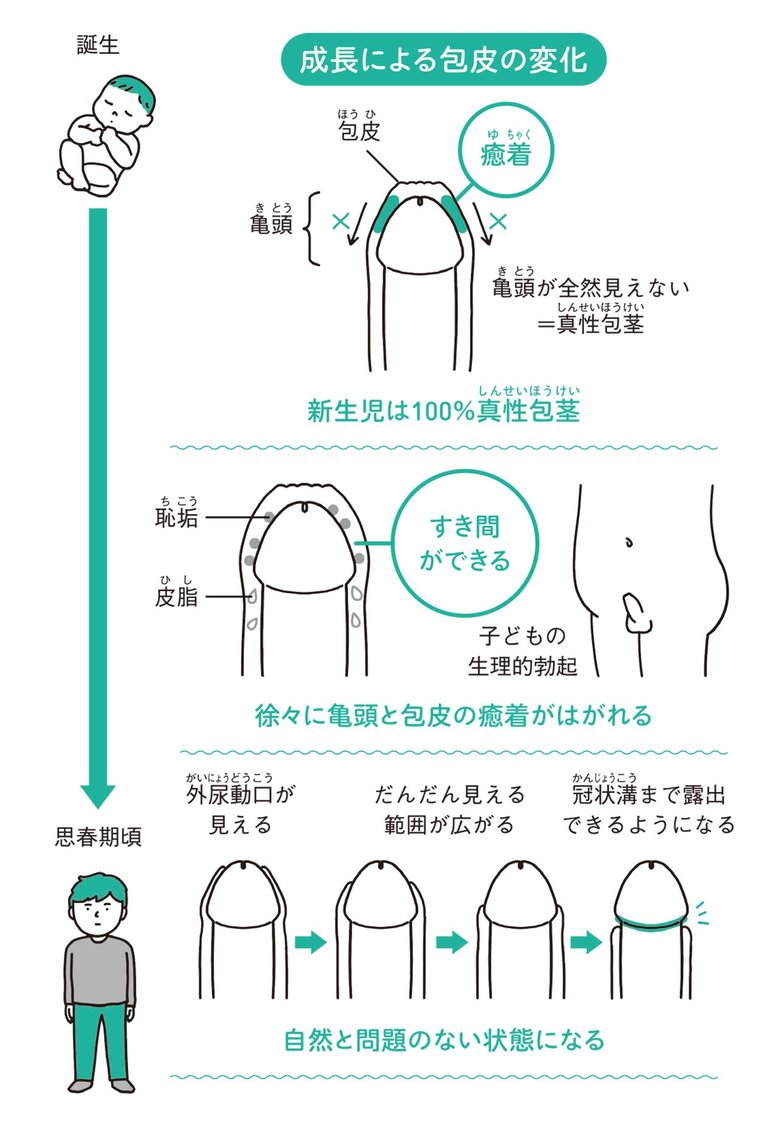 皮を剥くってどこまで男児のむくむかない問題の曖昧さ医師に聞くCHANTO WEB